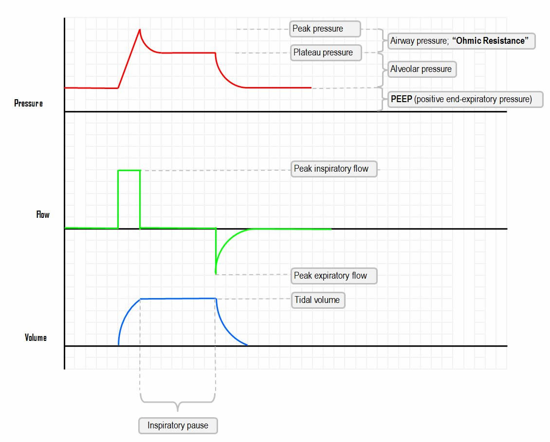 An introduction to the ventilator waveform | Deranged Physiology An introduction to the ventilator waveform | Deranged Physiology